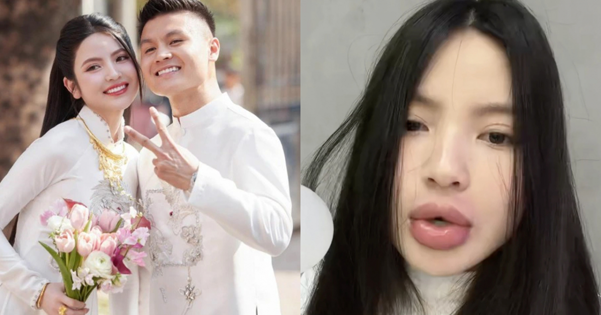 Vợ Quang Hải khiến dân tình hết hồn, suýt nhìn không ra vì đôi môi khác lạ