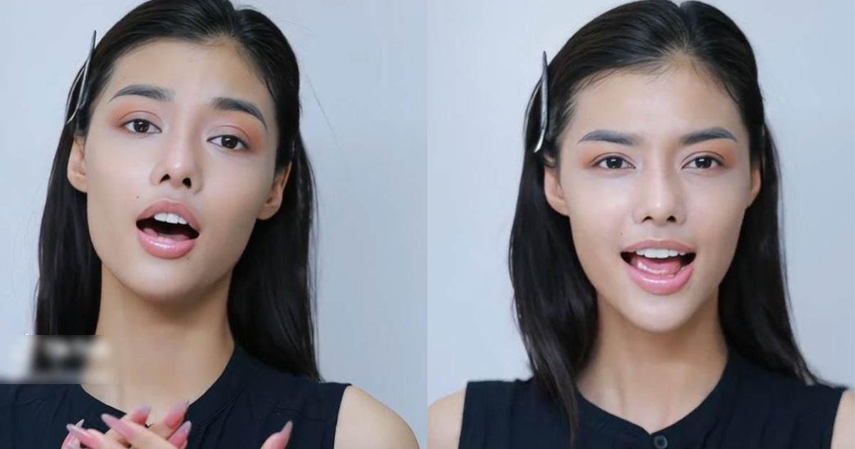 Nghiện phẫu thuật thẩm mỹ, á hậu Lona Kiều Loan khiến CĐM hoang mang trước gương mặt biến đổi lạ ...